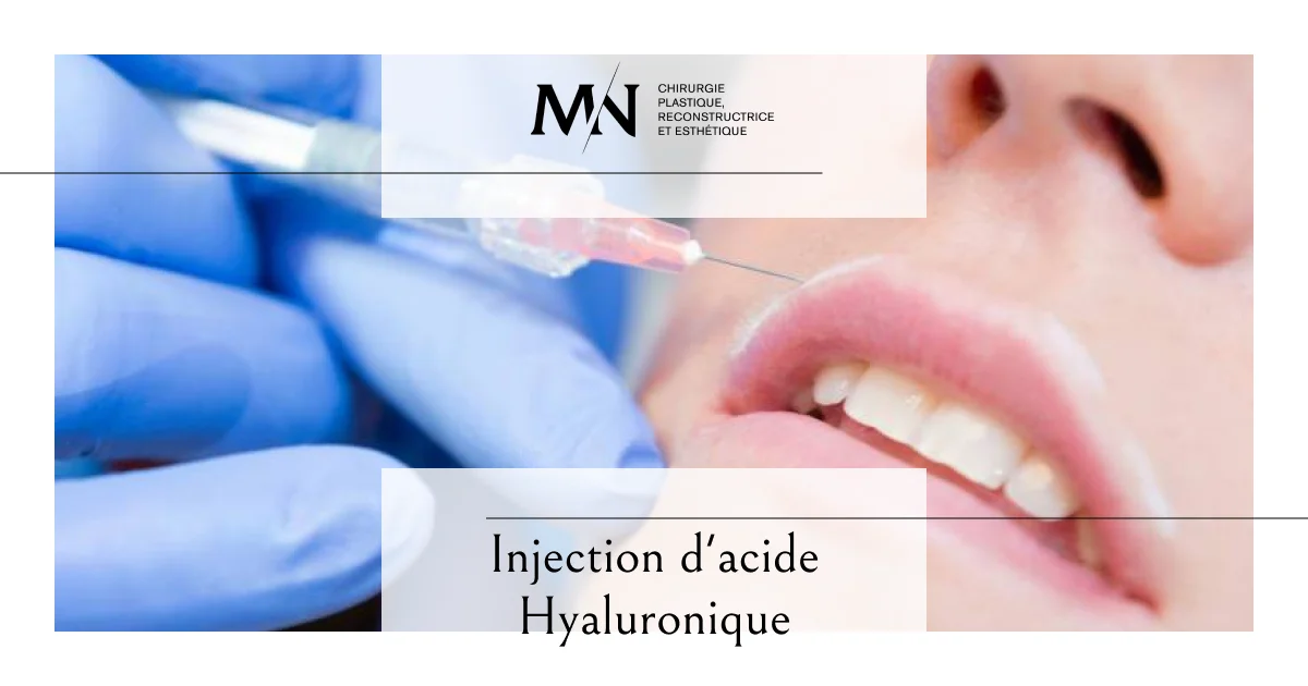 DR NICOLAÏ MIKAËL – Injection d'acide Hyaluronique